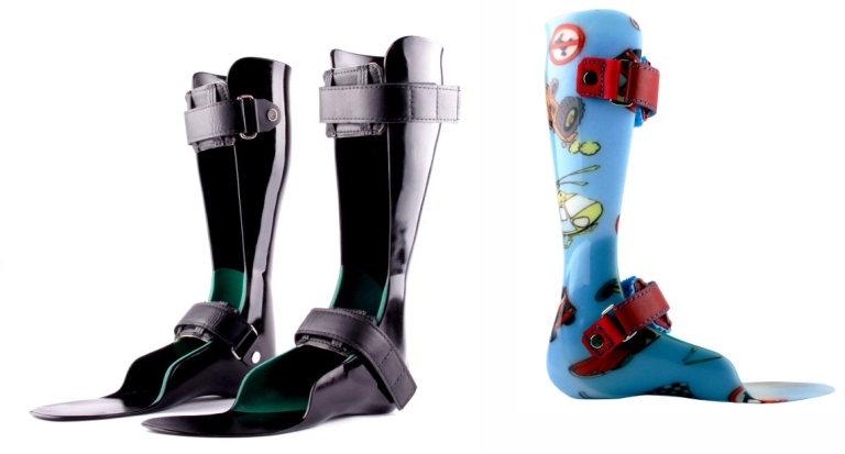 AFO's and Moulded Items - MAG Orthotics