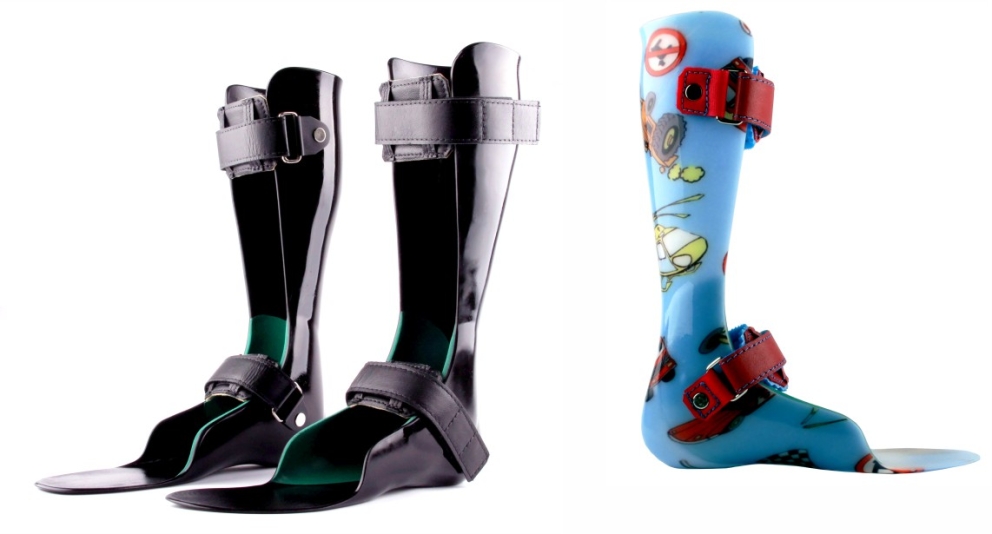 AFO's and Moulded Items - MAG Orthotics